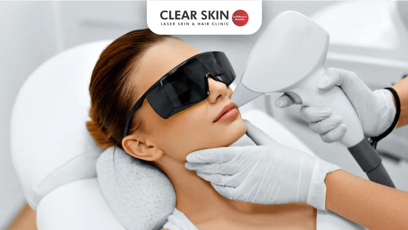 How Many Laser Treatments for Permanent Hair Removal are Effective?