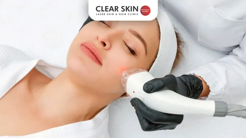 Laser Hair Removal: Tips for Sensitive Skin | Clear Skin Pune