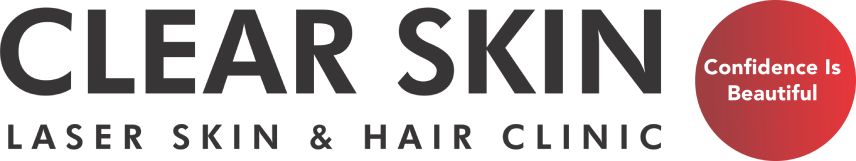 5 Easy Ways to Remove Acne Marks | Clear Skin Clinic